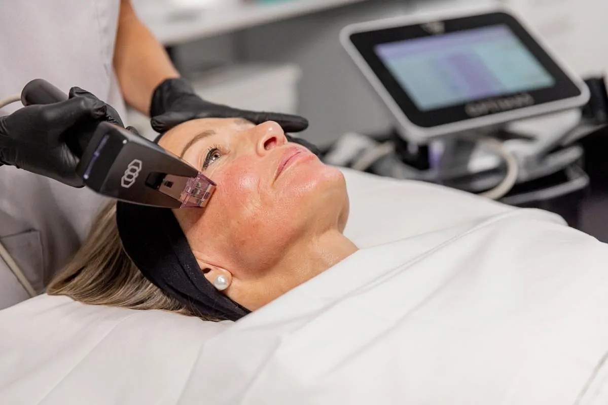 Morpheus Pro: Rejuvenecimiento facial y corporal